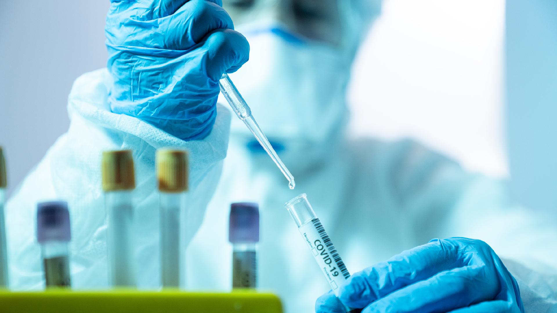 Cell journal: Intl scientists knock virus lab-leak theory - CGTN