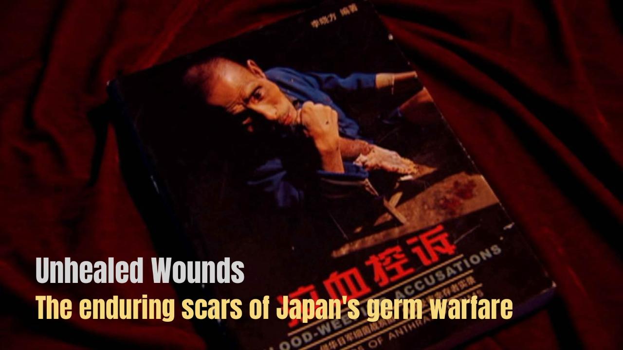 Unhealed wounds: The enduring scars of Japan's germ warfare - CGTN